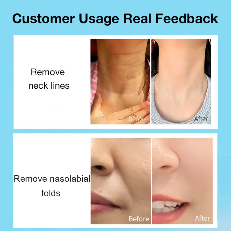 Skin Lifting & Firming Massage-Remove Wrinkle,V Face Therapy Beauty Device